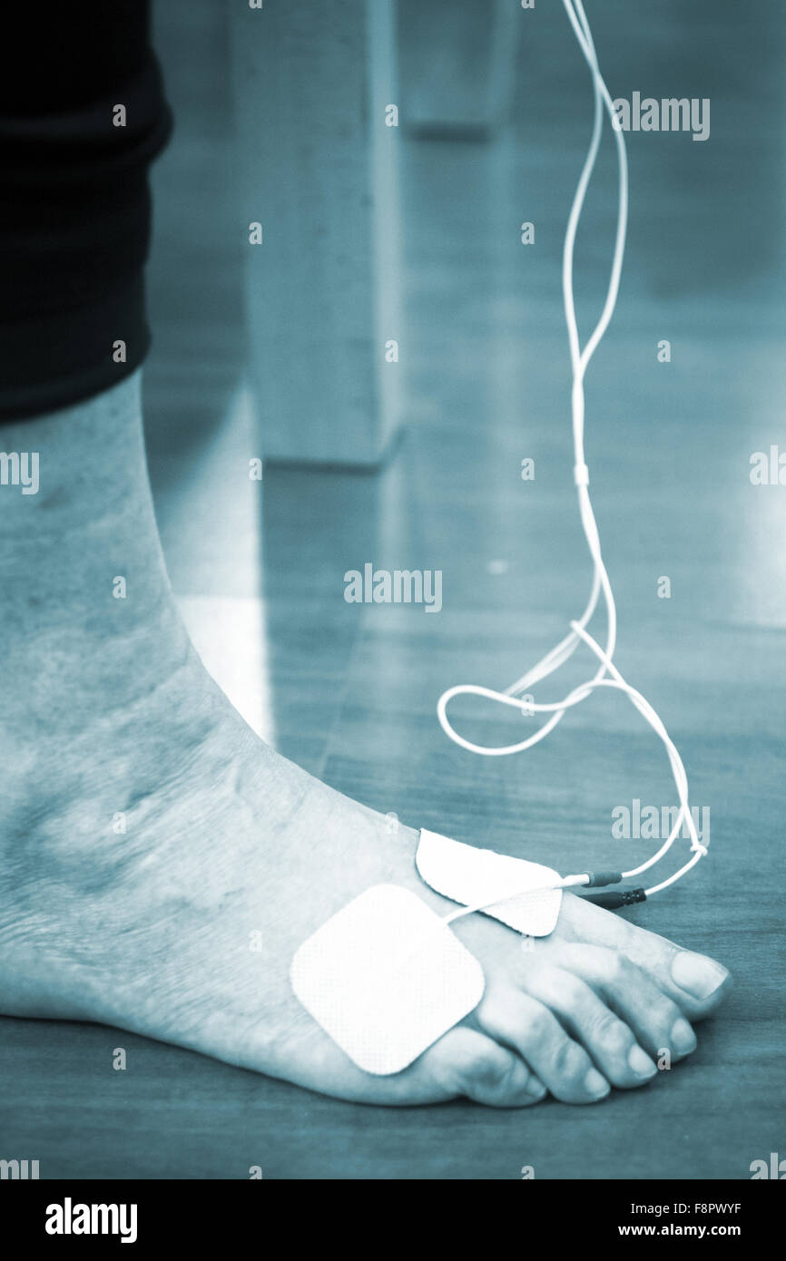 Patient foot, leg and ankle in electro physiotherapy electrical impulse ...