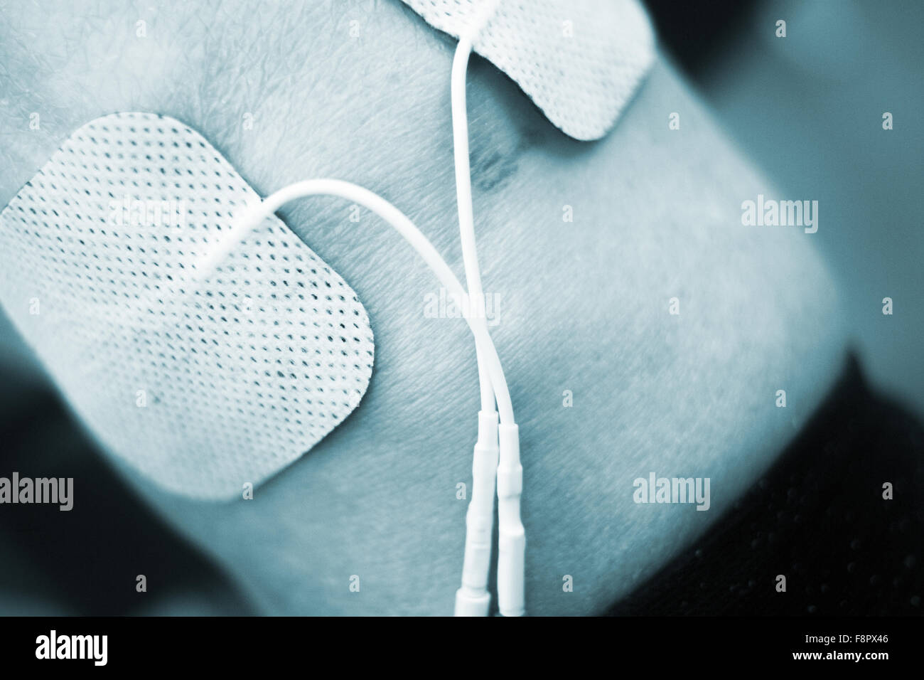 Patient leg and knee in electro physiotherapy electrical impulse ...