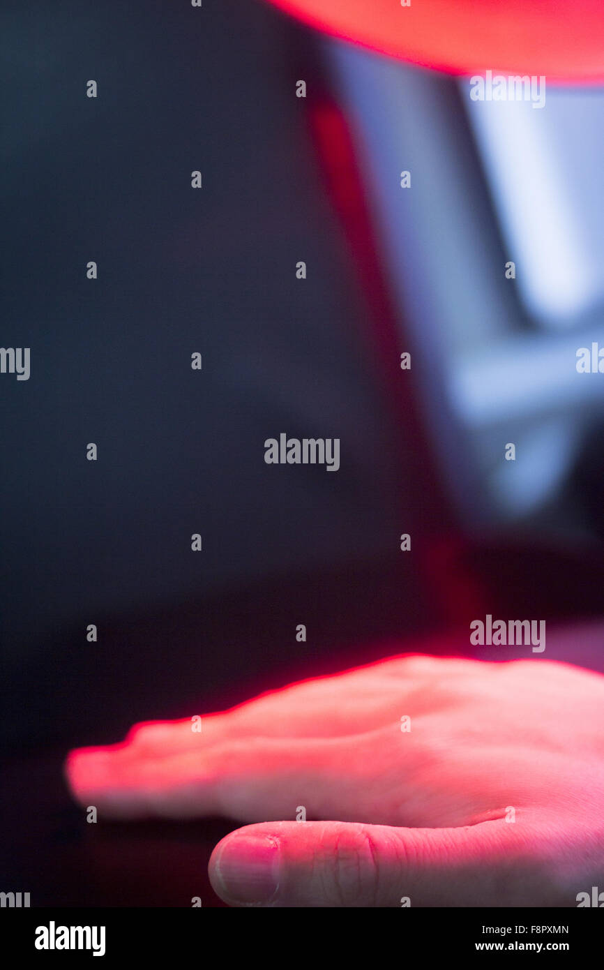 Patient hand in red physiotherapy heat treatment under hot light Stock ...