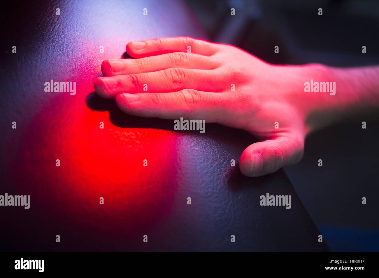 Patient hand in red physiotherapy heat treatment under hot light Stock ...