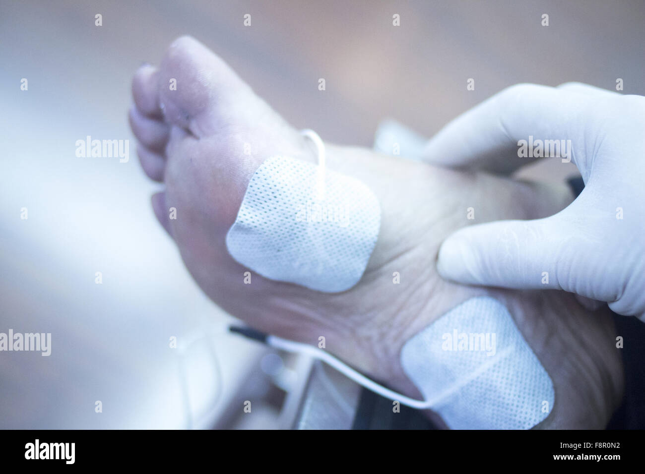 Patient foot, leg and ankle in electro physiotherapy electrical impulse ...