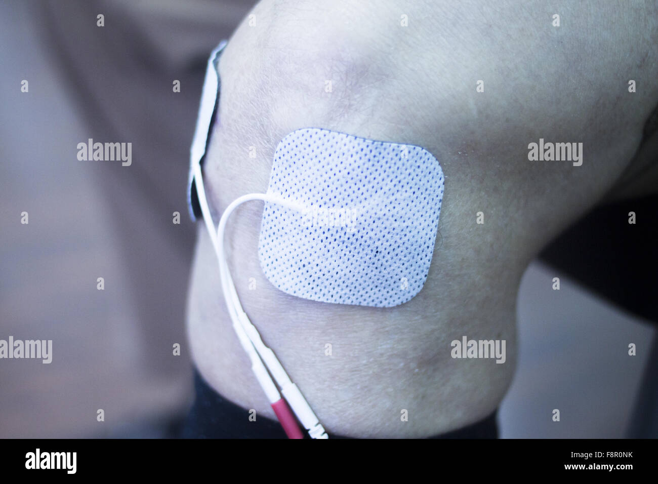 Patient leg and knee in electro physiotherapy electrical impulse ...