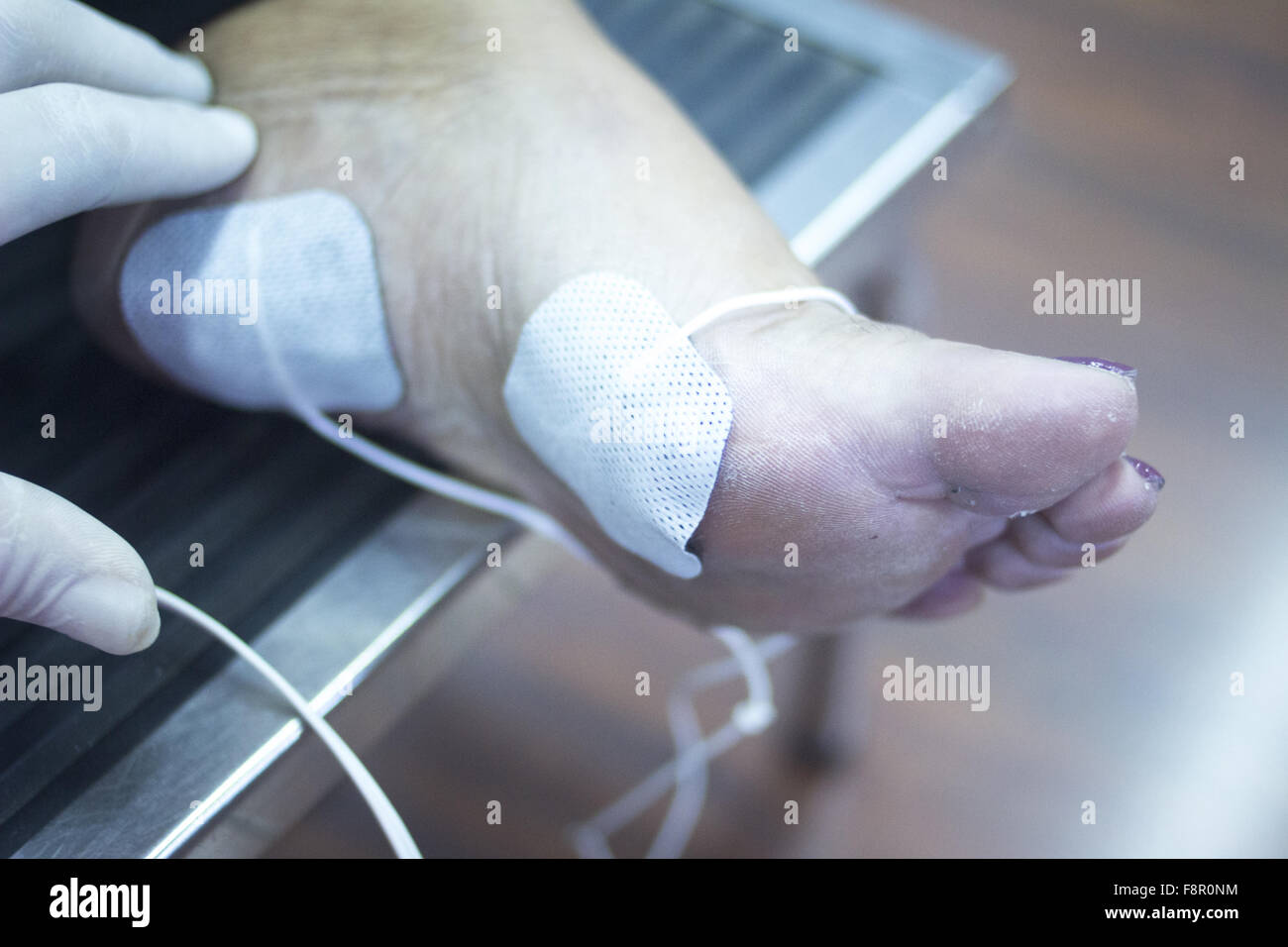 Patient foot, leg and ankle in electro physiotherapy electrical impulse ...