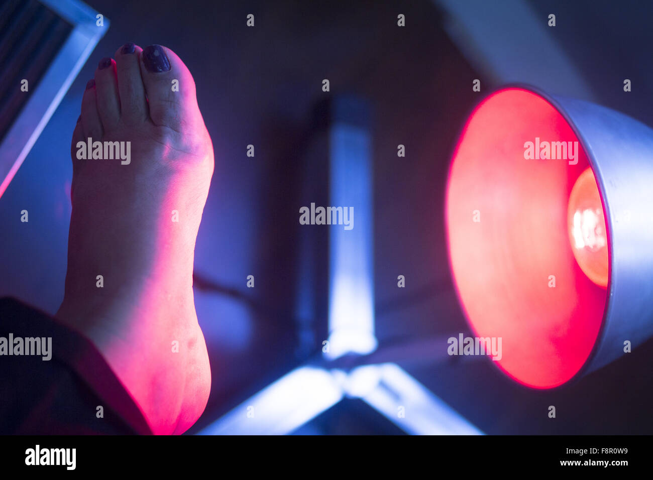 Patient foot in red physiotherapy heat treatment under hot light Stock ...