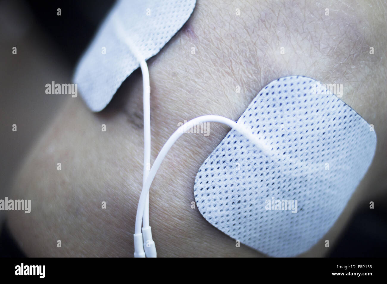 Patient leg and knee in electro physiotherapy electrical impulse ...