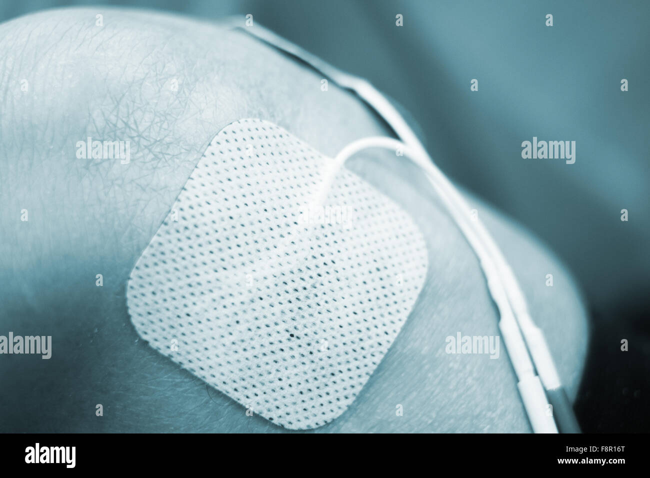 Patient leg and knee in electro physiotherapy electrical impulse ...