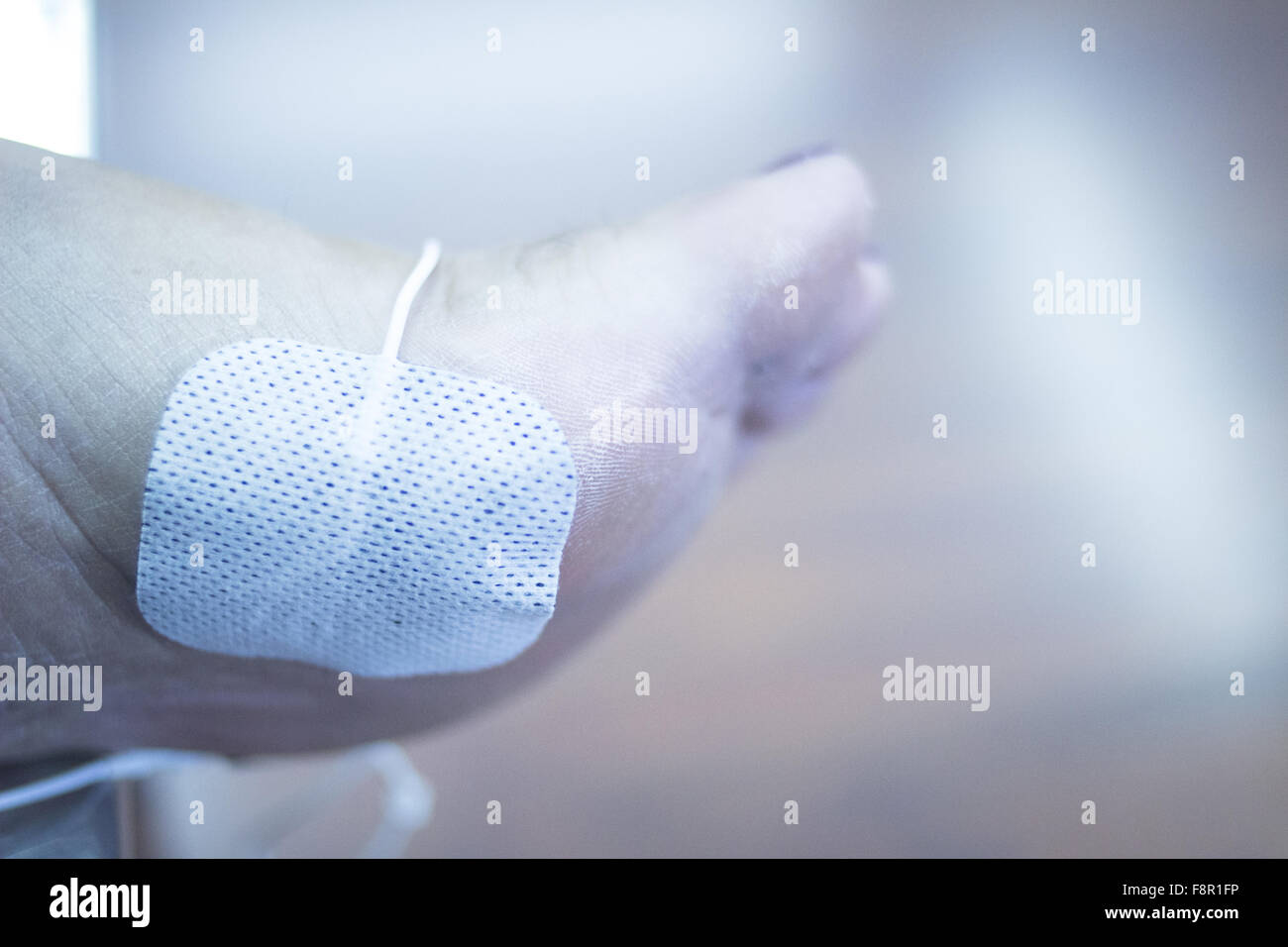 Patient foot, leg and ankle in electro physiotherapy electrical impulse ...