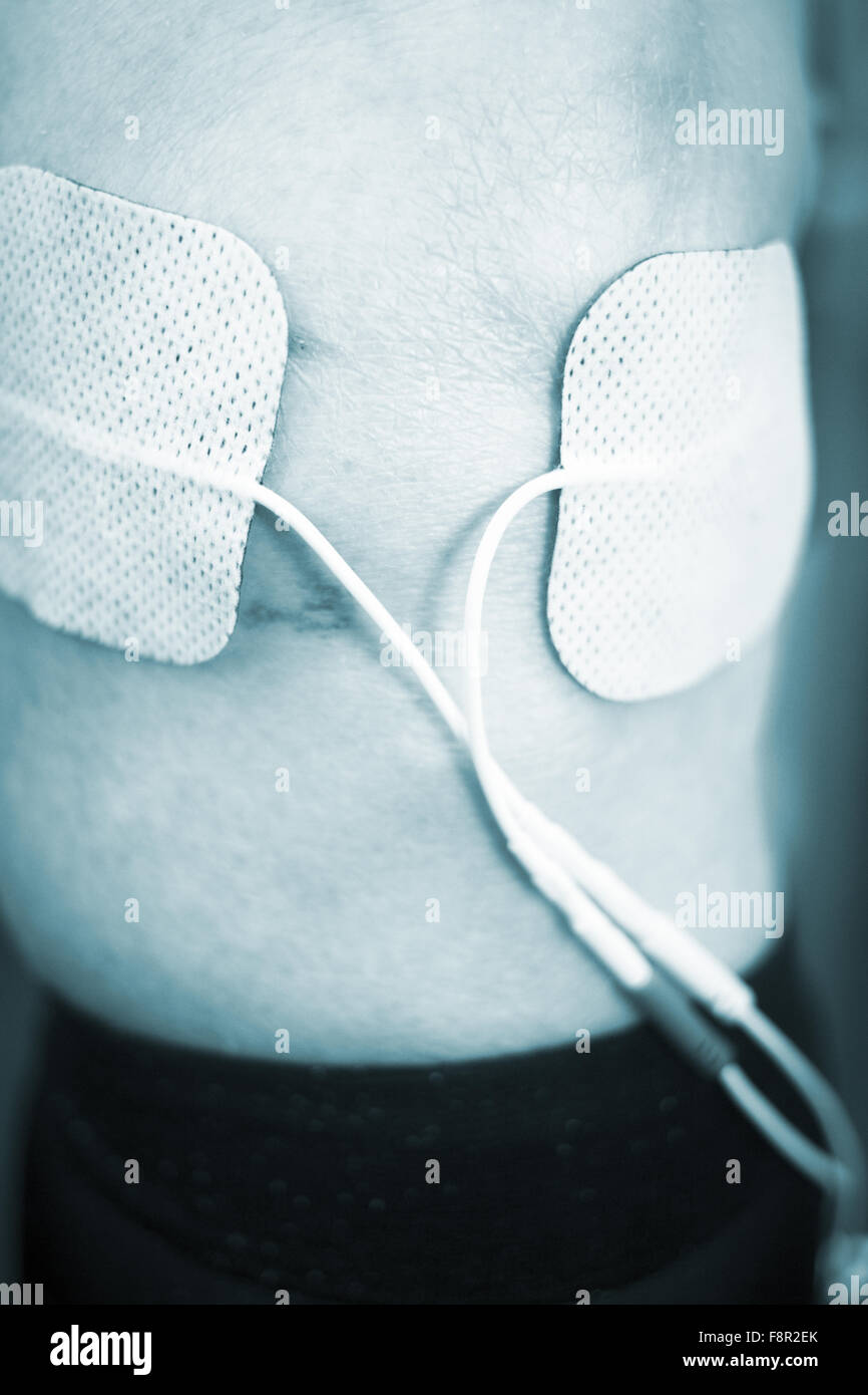 Patient leg and knee in electro physiotherapy electrical impulse ...