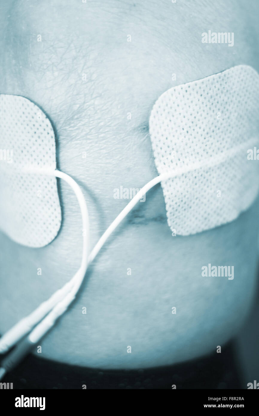 Patient leg and knee in electro physiotherapy electrical impulse ...