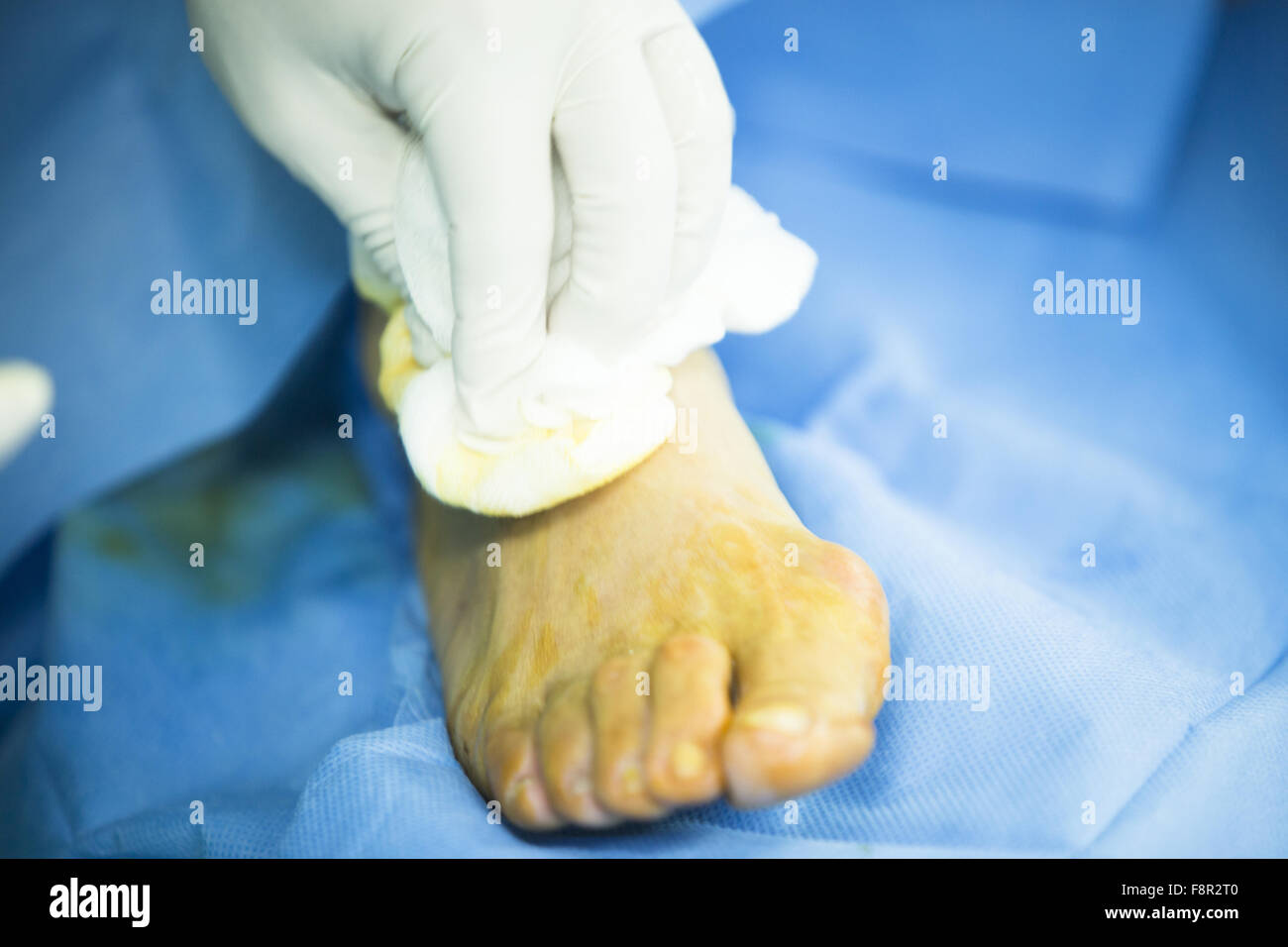 Hospital emergency orthopedics and traumatology surgery operating room ...
