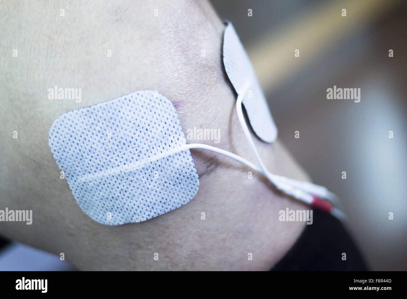 Patient leg and knee in electro physiotherapy electrical impulse ...