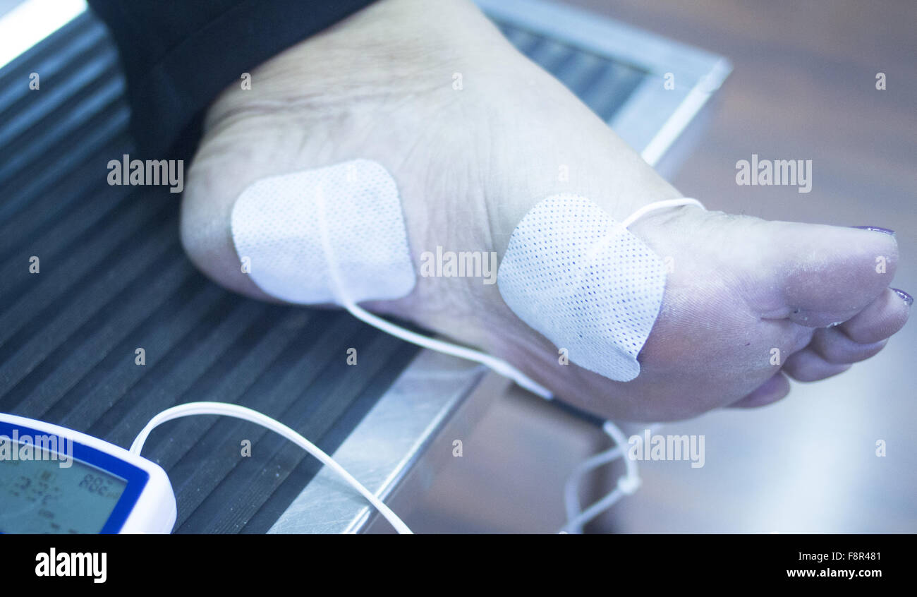 Patient foot, leg and ankle in electro physiotherapy electrical impulse ...