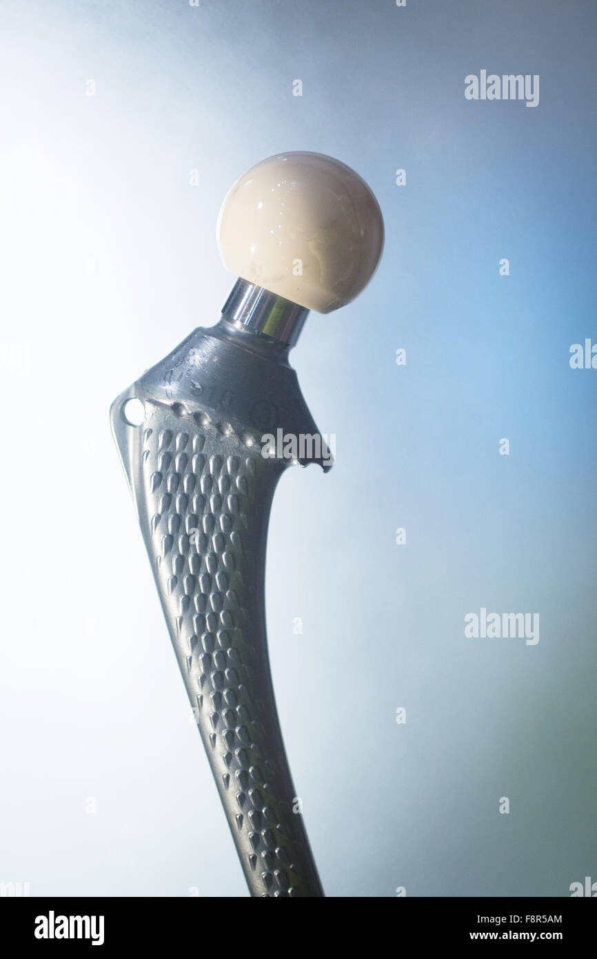 Traumatology and orthopedic surgery prosthetic titanium hip implant ...