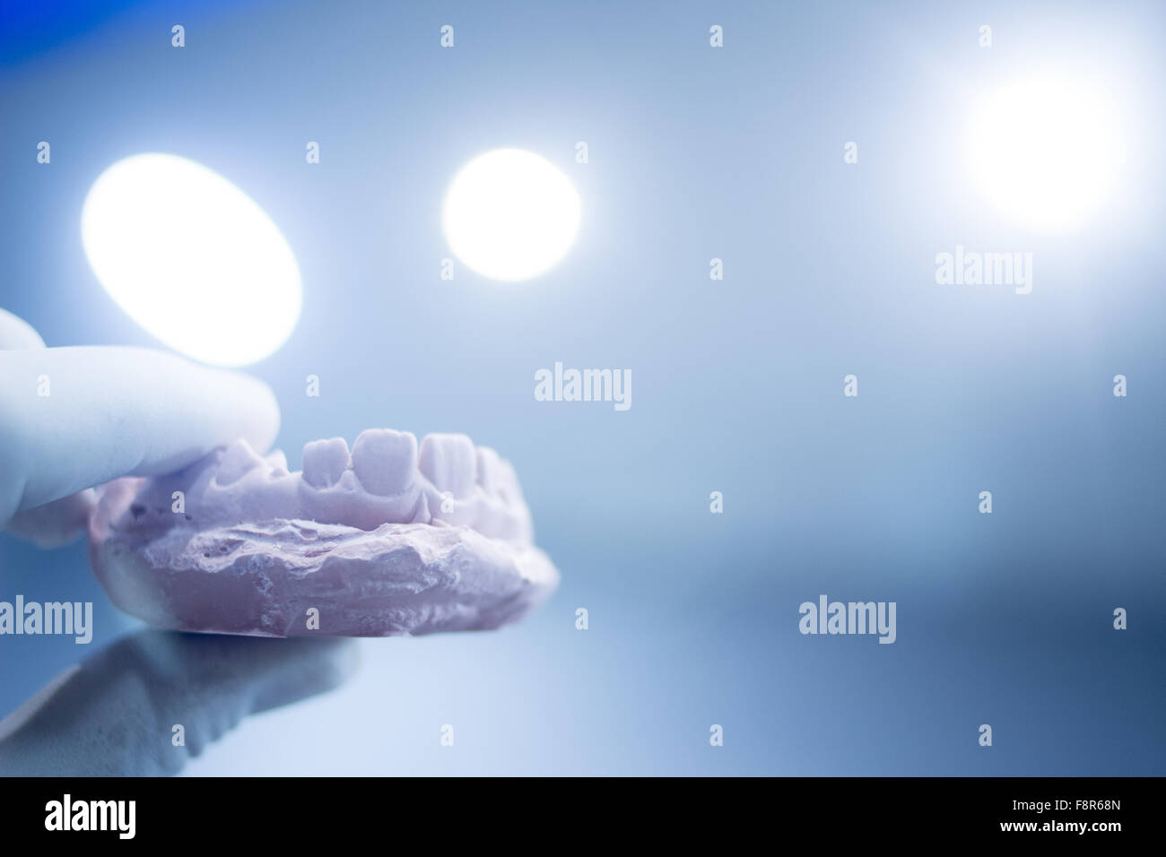 Dental mold dentist clay teeth plate ceramic colored cast model showing ...