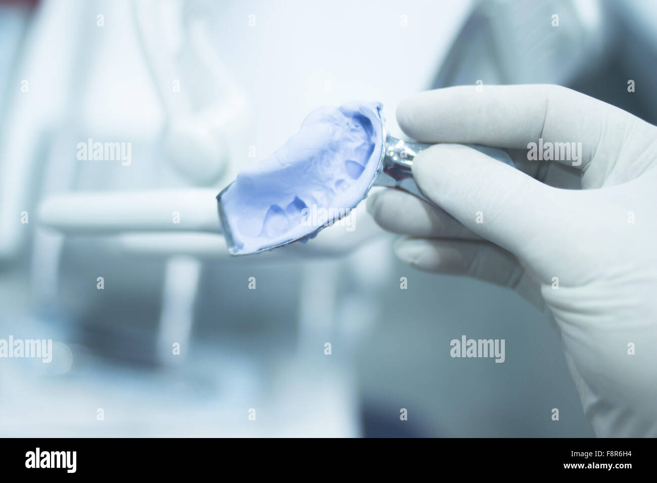 Dental mold dentist clay teeth plate gel gum colored cast model showing ...