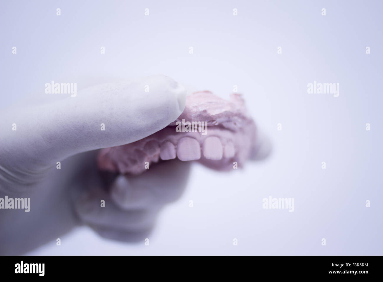 Dental mold dentist clay teeth plate ceramic colored cast model showing ...