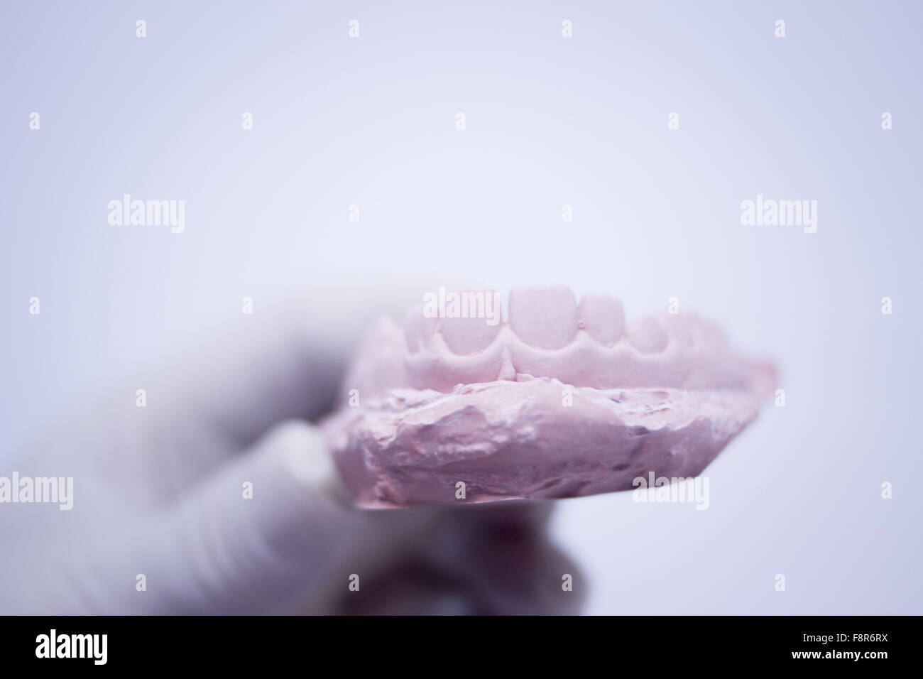 Dental mold dentist clay teeth plate ceramic colored cast model showing ...