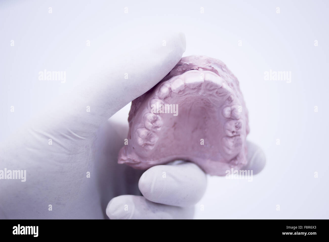 Dental mold dentist clay teeth plate ceramic colored cast model showing ...