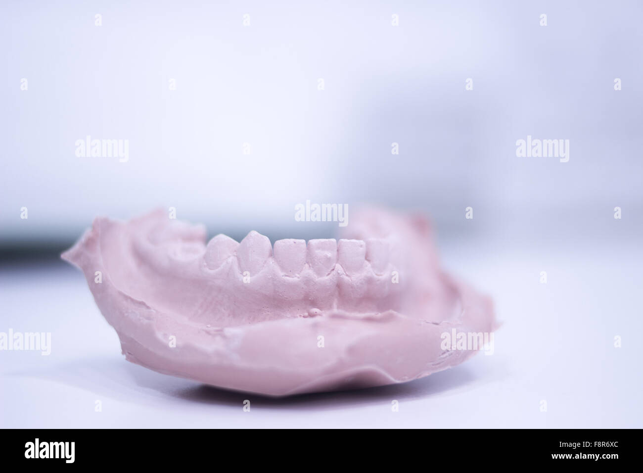 Dental mold dentist clay teeth plate ceramic colored cast model showing ...