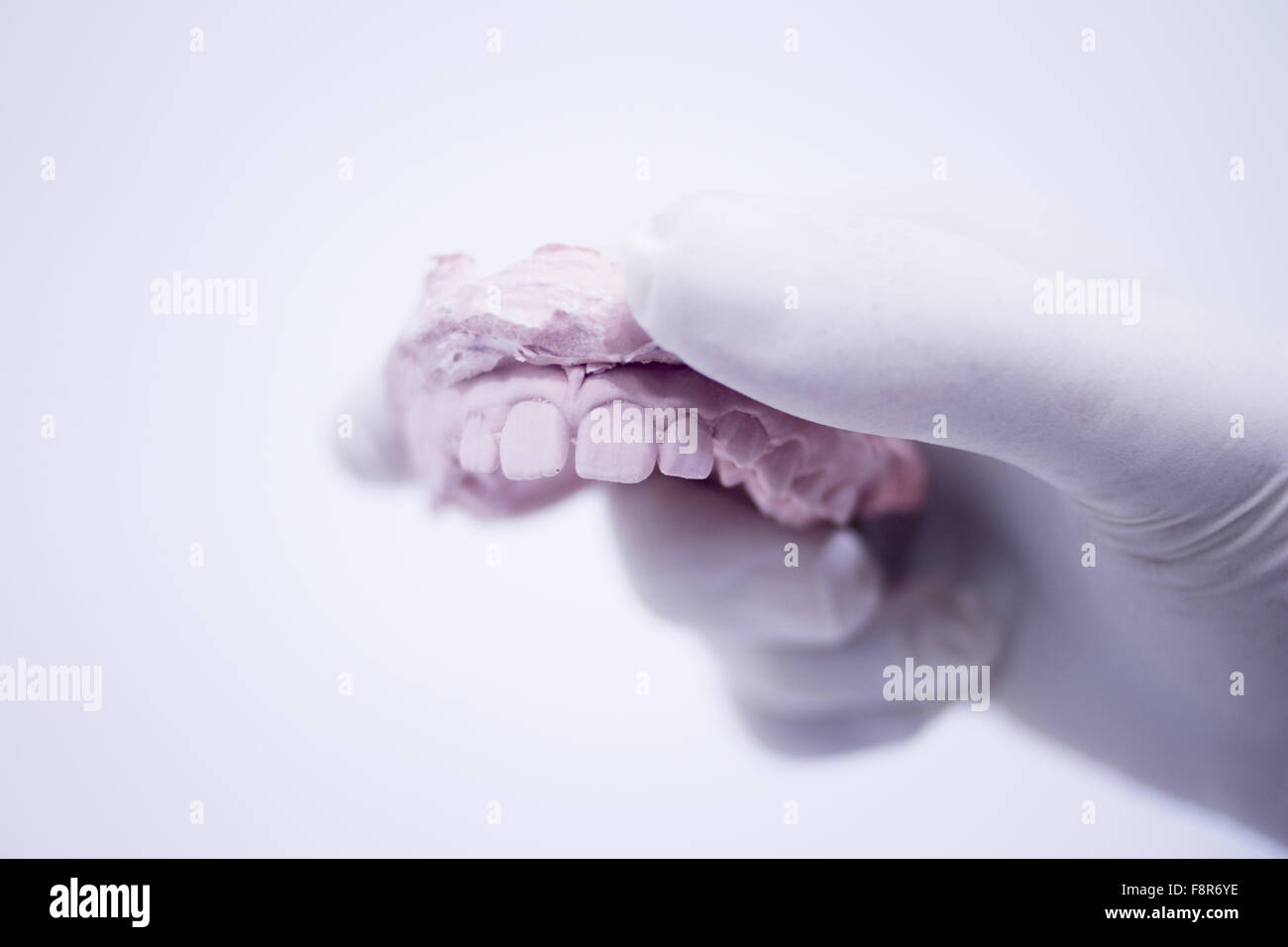 Dental mold dentist clay teeth plate ceramic colored cast model showing ...