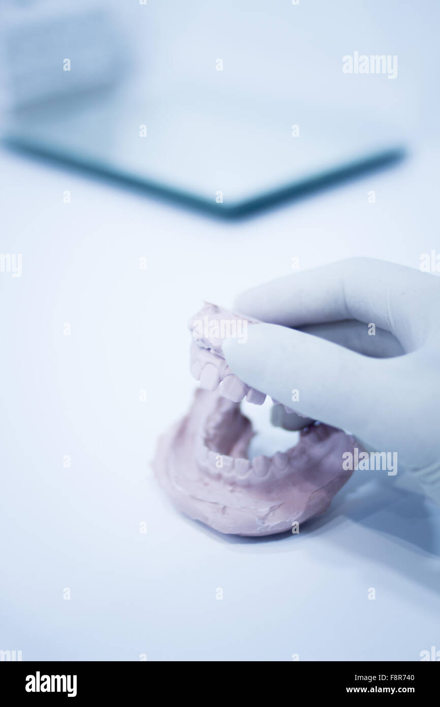 Dental mold dentist clay teeth plate ceramic colored cast model showing ...