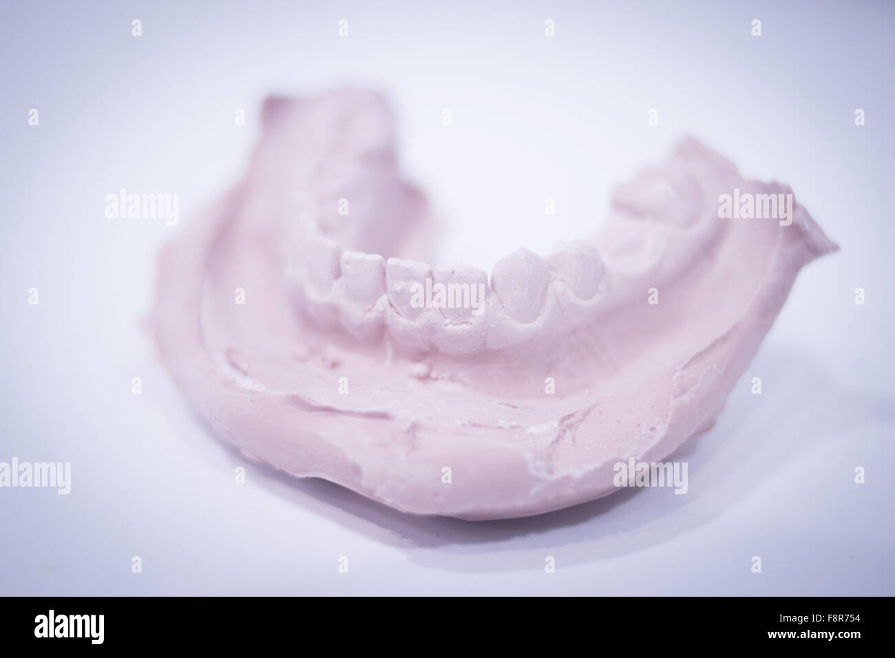 Dental mold dentist clay teeth plate ceramic colored cast model showing ...