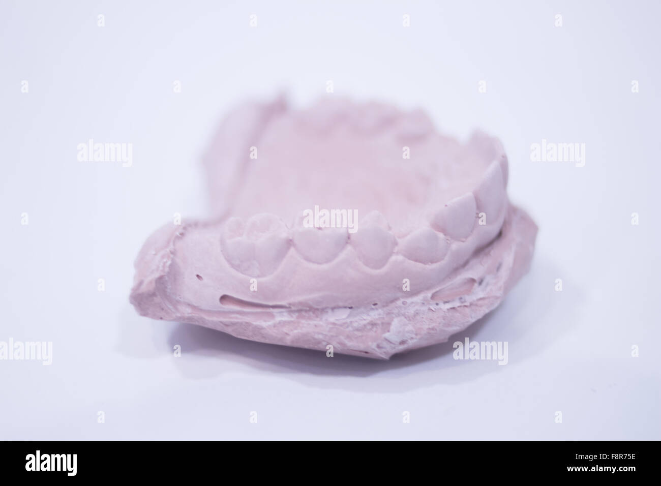 Dental mold dentist clay teeth plate ceramic colored cast model showing ...