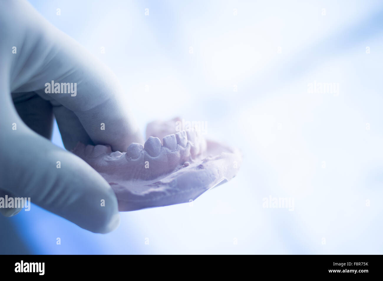 Dental mold dentist clay teeth plate ceramic colored cast model showing ...