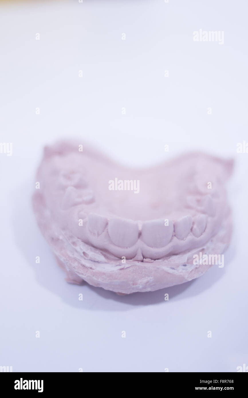 Dental mold dentist clay teeth plate ceramic colored cast model showing ...