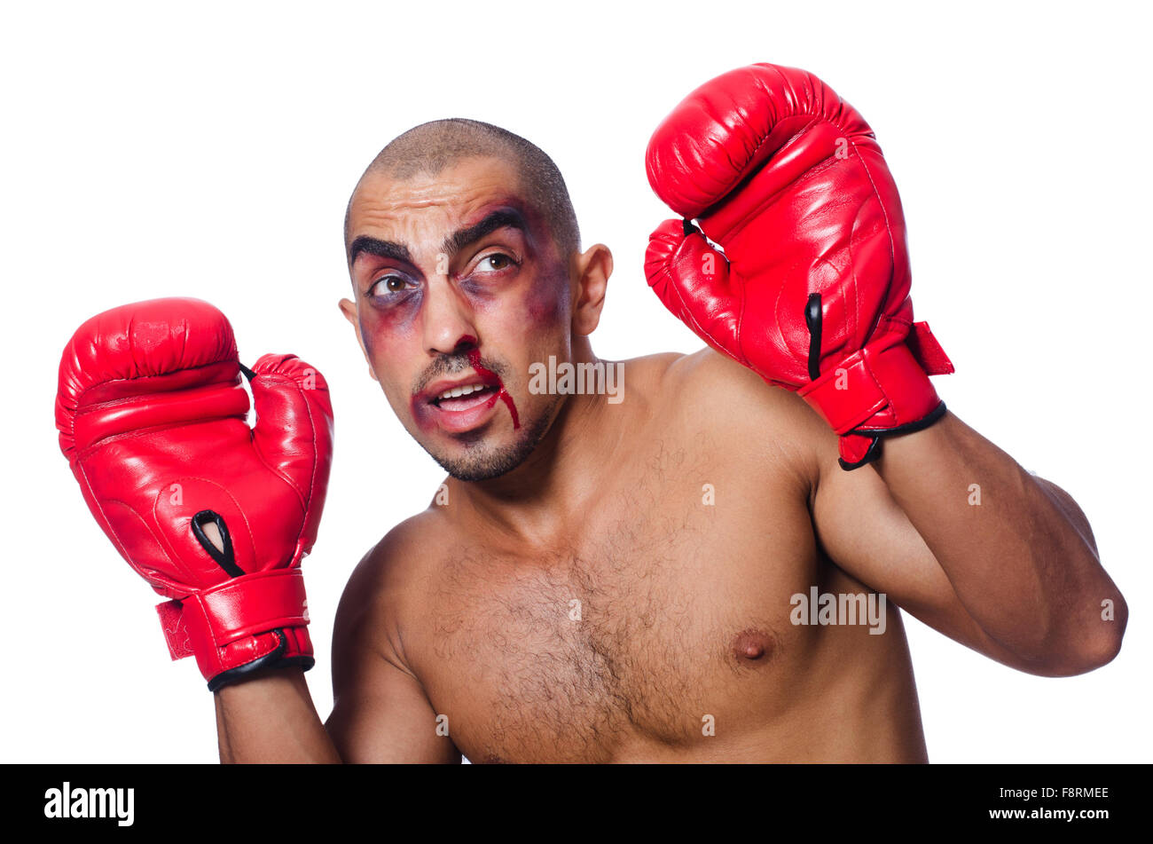 Badly beaten boxer isolated on white Stock Photo - Alamy