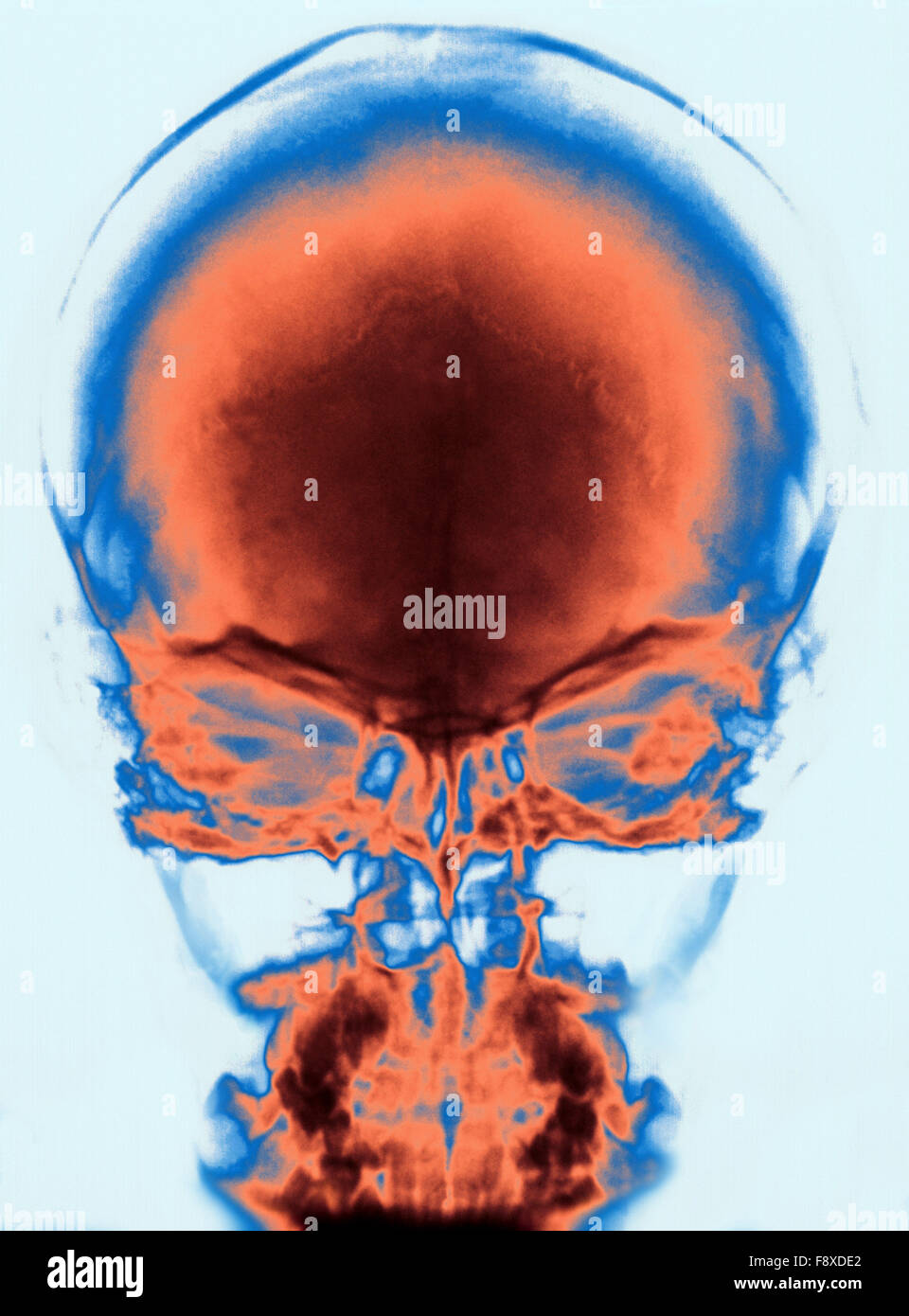 Magnetic resonance imaging human skeleton hi-res stock photography and ...