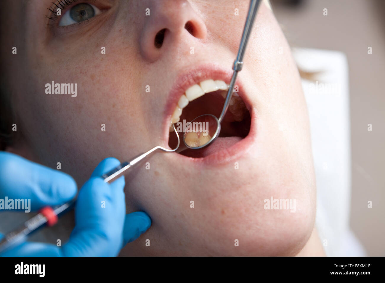 Checking for dental cavities Stock Photo - Alamy