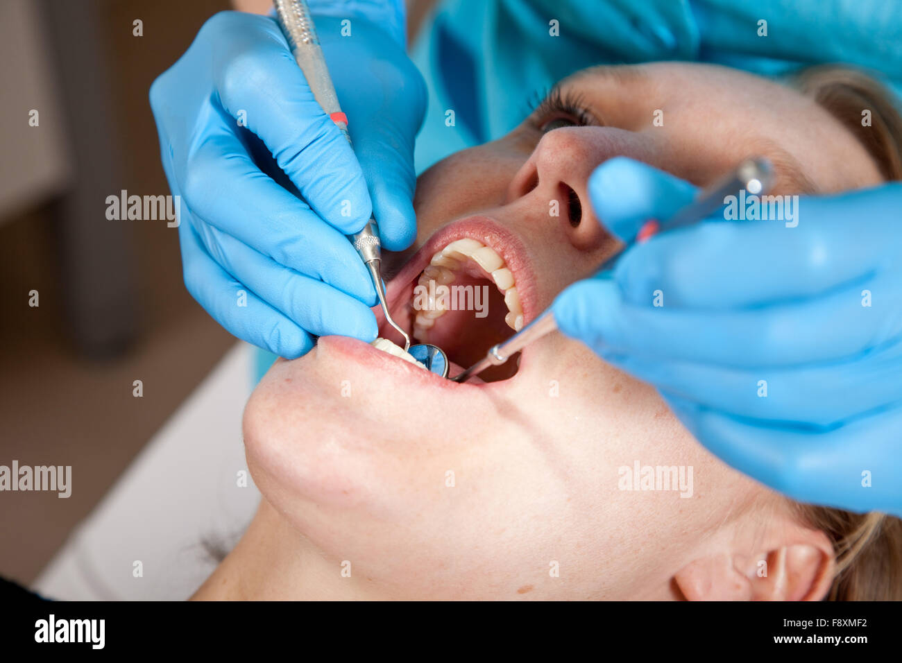 Checking for cavities Stock Photo - Alamy