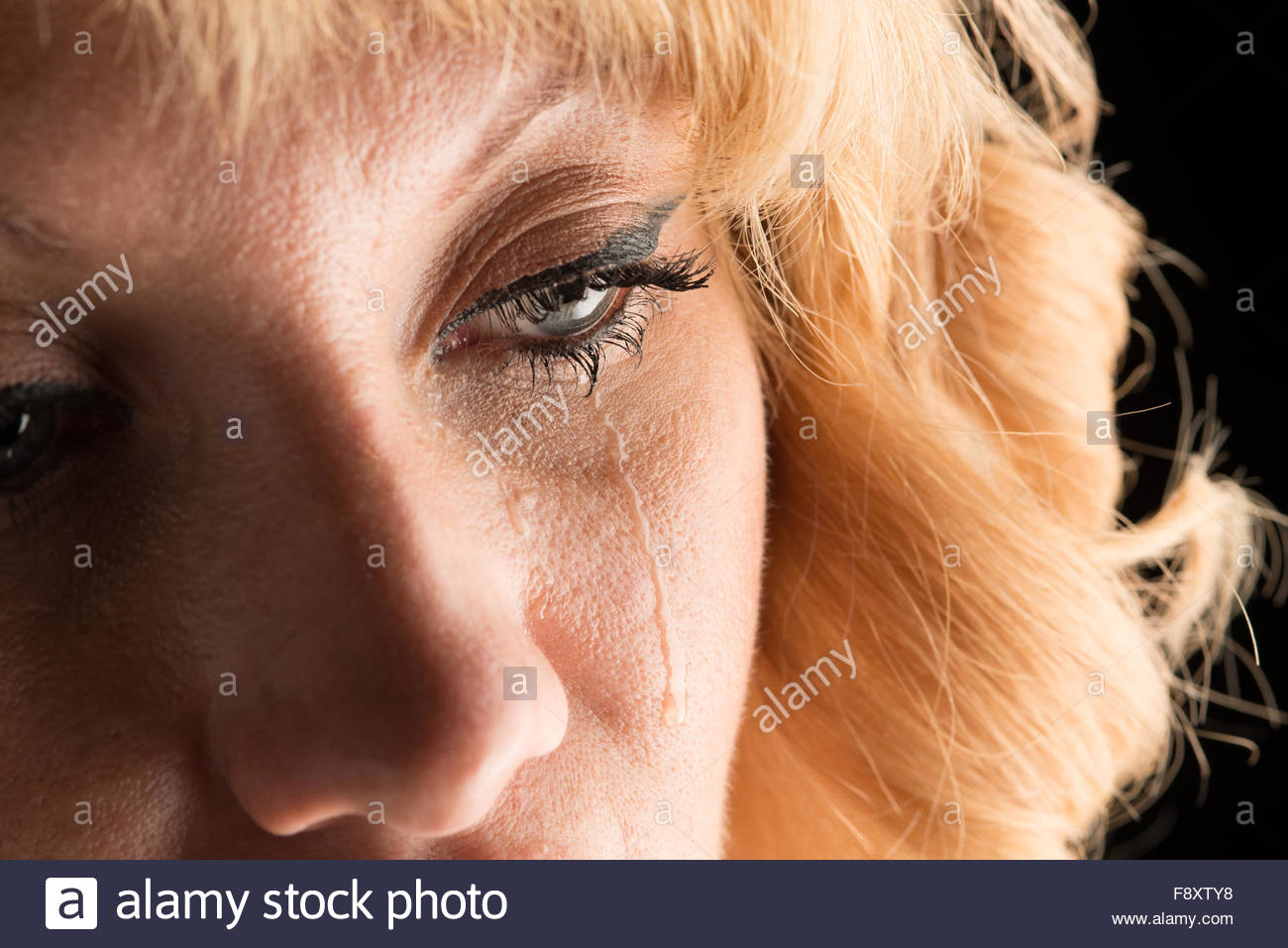 Girl Black Eye Crying Stock Photos & Girl Black Eye Crying Stock Images ...