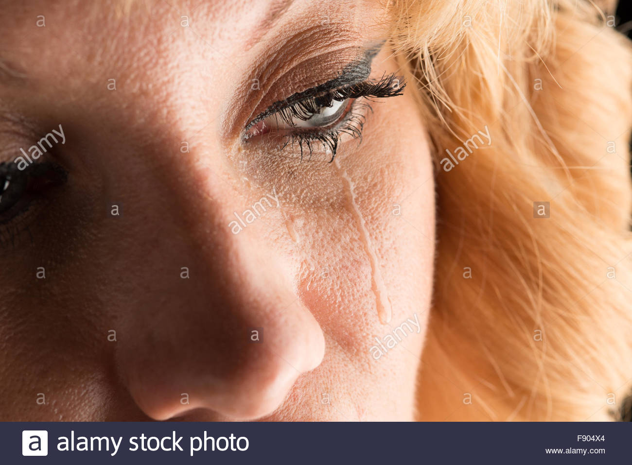 Girl Black Eye Crying Stock Photos & Girl Black Eye Crying Stock Images ...