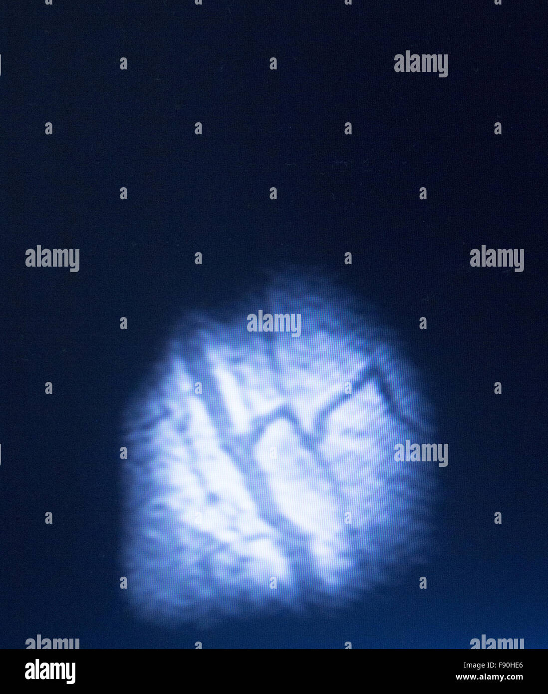 MRI magnetic resonance imaging medical scan test results of hand and ...