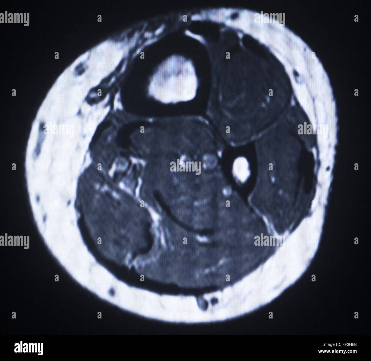 MRI magnetic resonance imaging medical scan test results showing ...