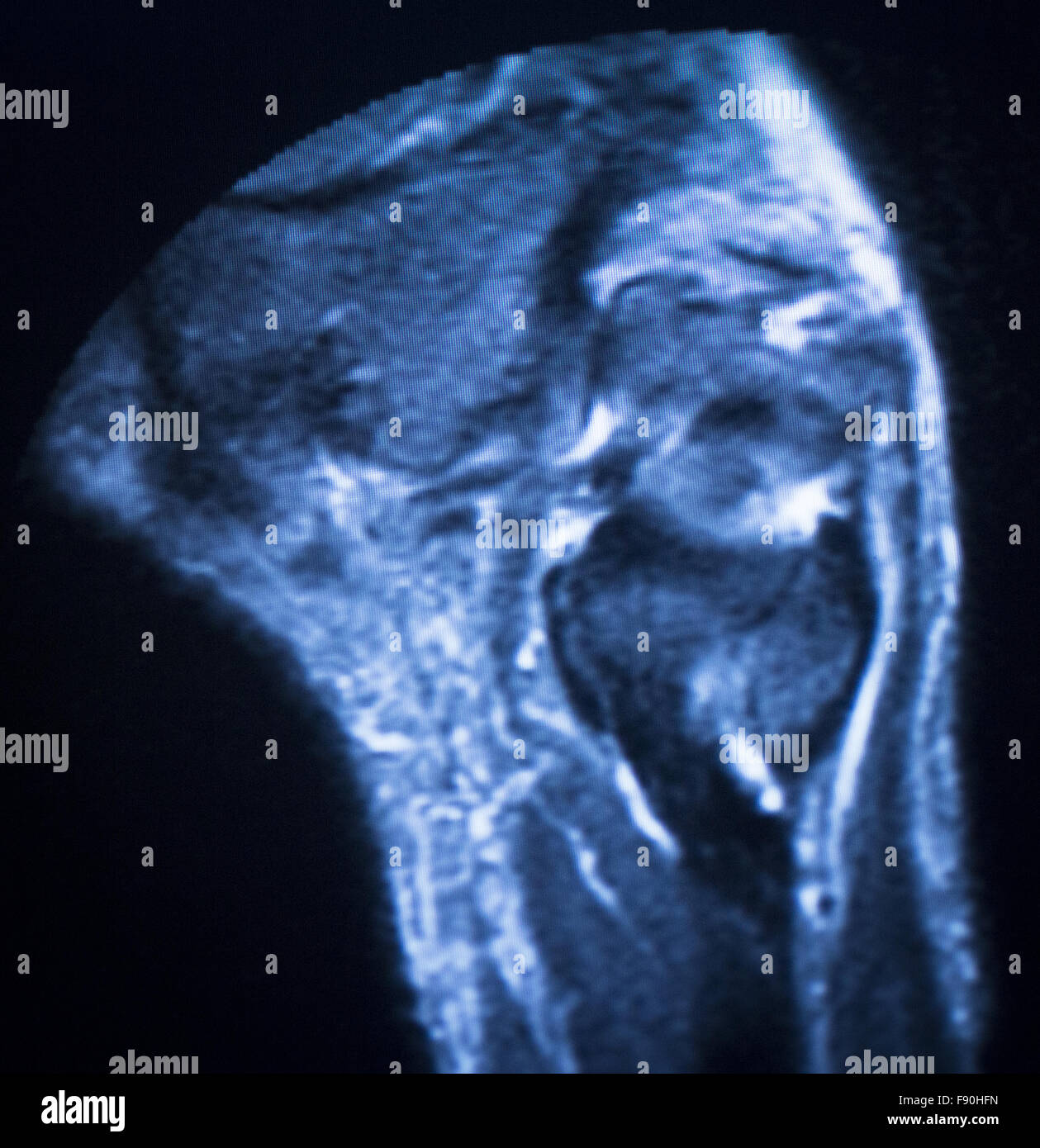 MRI magnetic resonance imaging medical scan test results showing ...