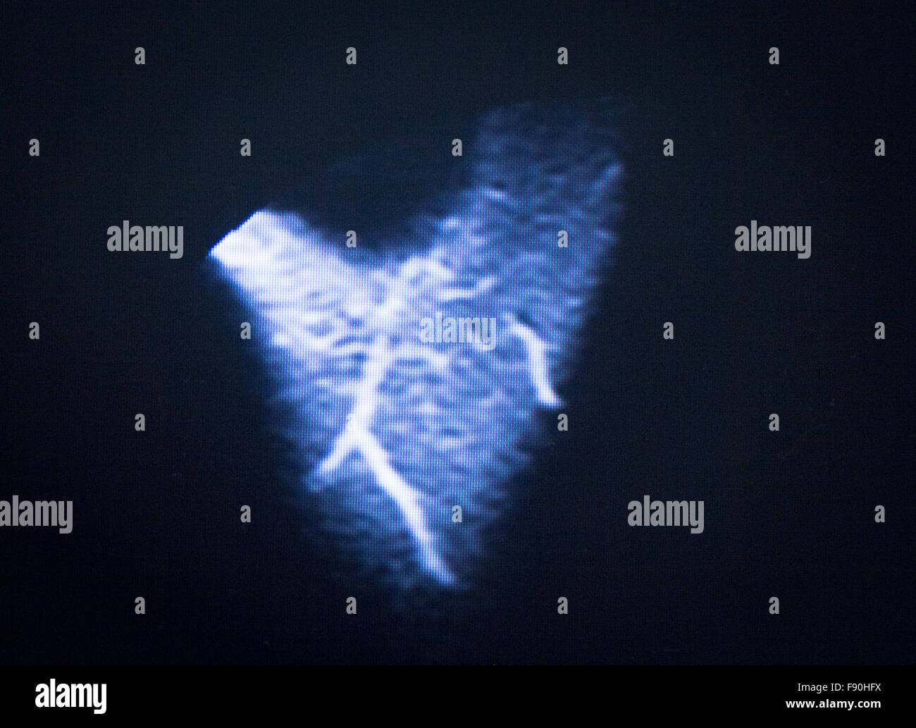 MRI magnetic resonance imaging medical scan test results showing ...
