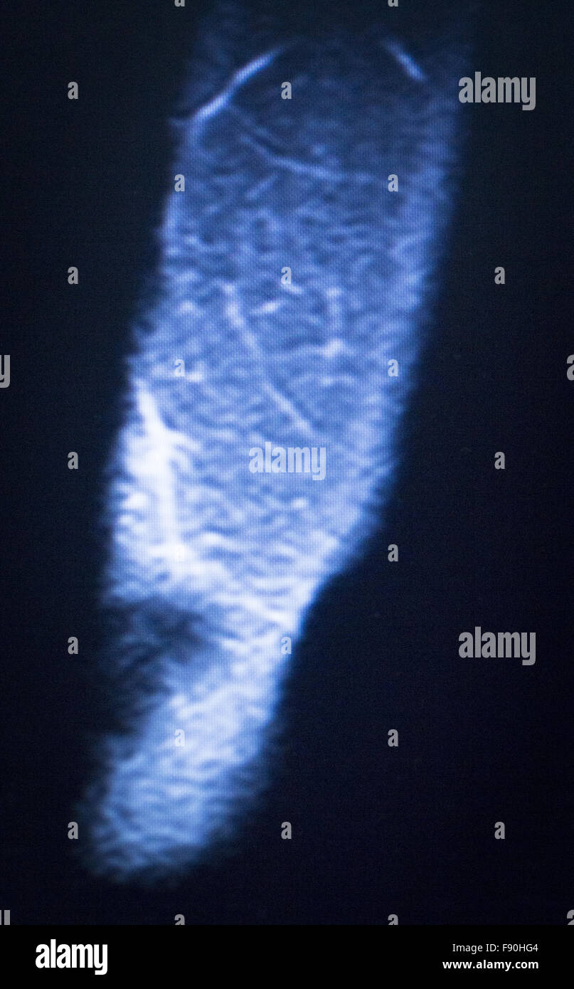 MRI magnetic resonance imaging medical scan test results showing ...