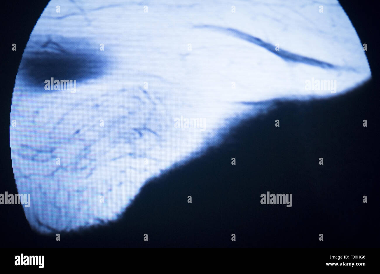 MRI magnetic resonance imaging medical scan test results showing knee ...