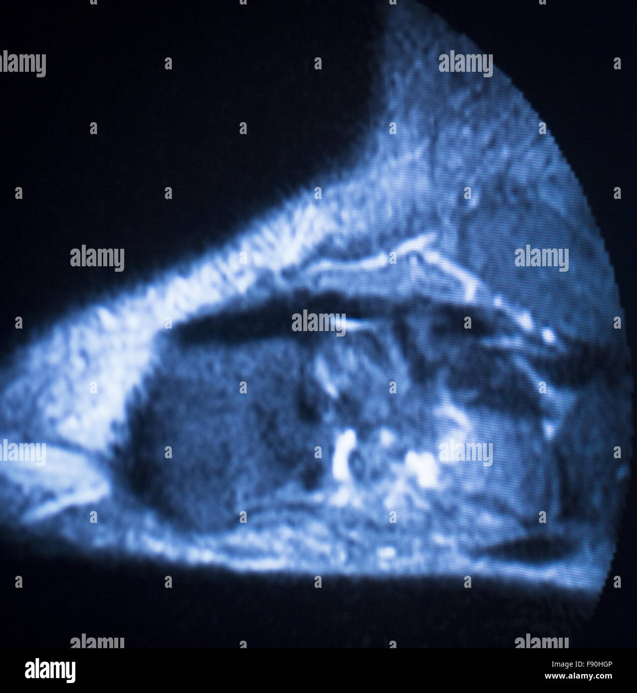 MRI magnetic resonance imaging medical scan test results showing ...