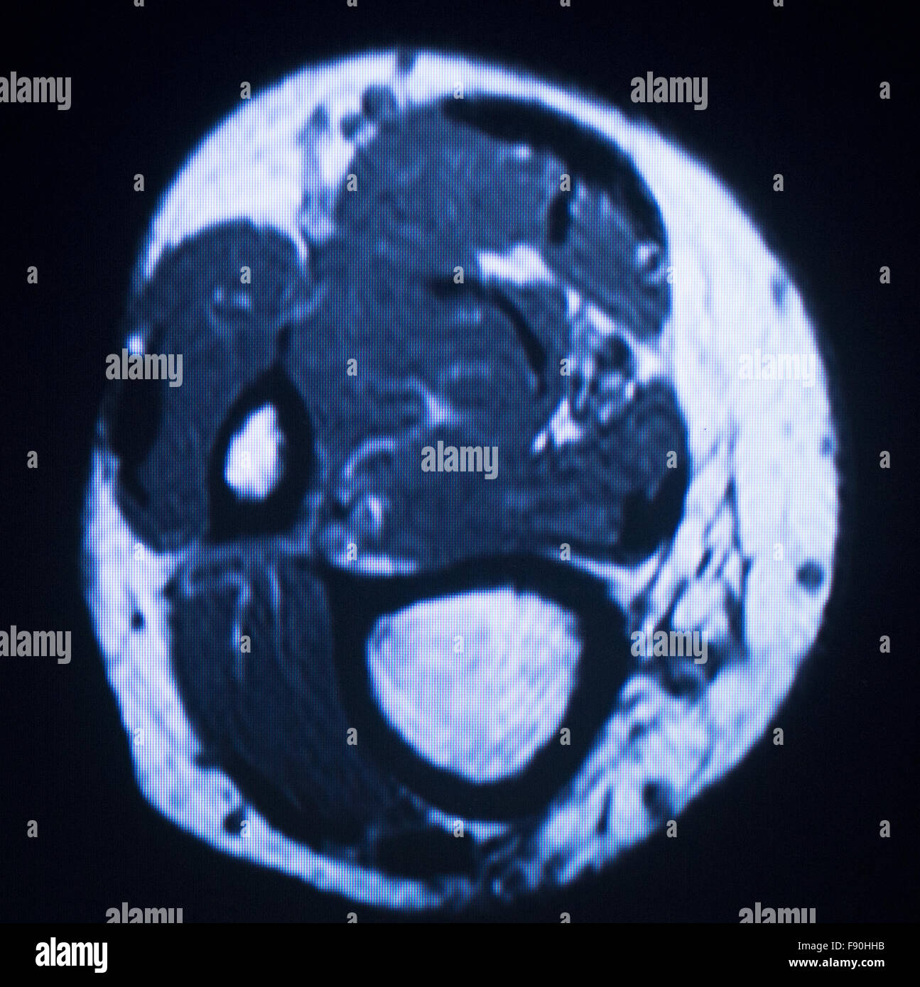 MRI magnetic resonance imaging medical scan test results showing ...