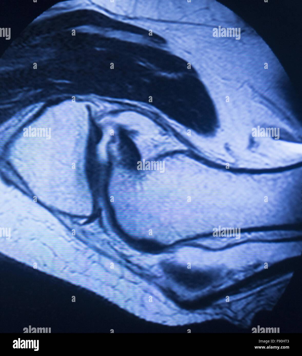 MRI magnetic resonance imaging medical scan test results showing knee ...
