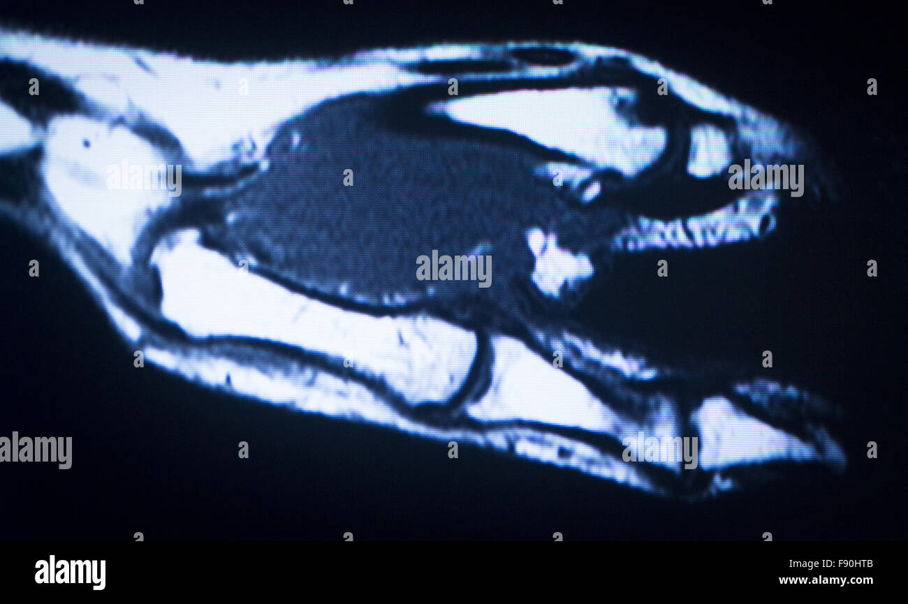 MRI magnetic resonance imaging medical scan test results showing ...