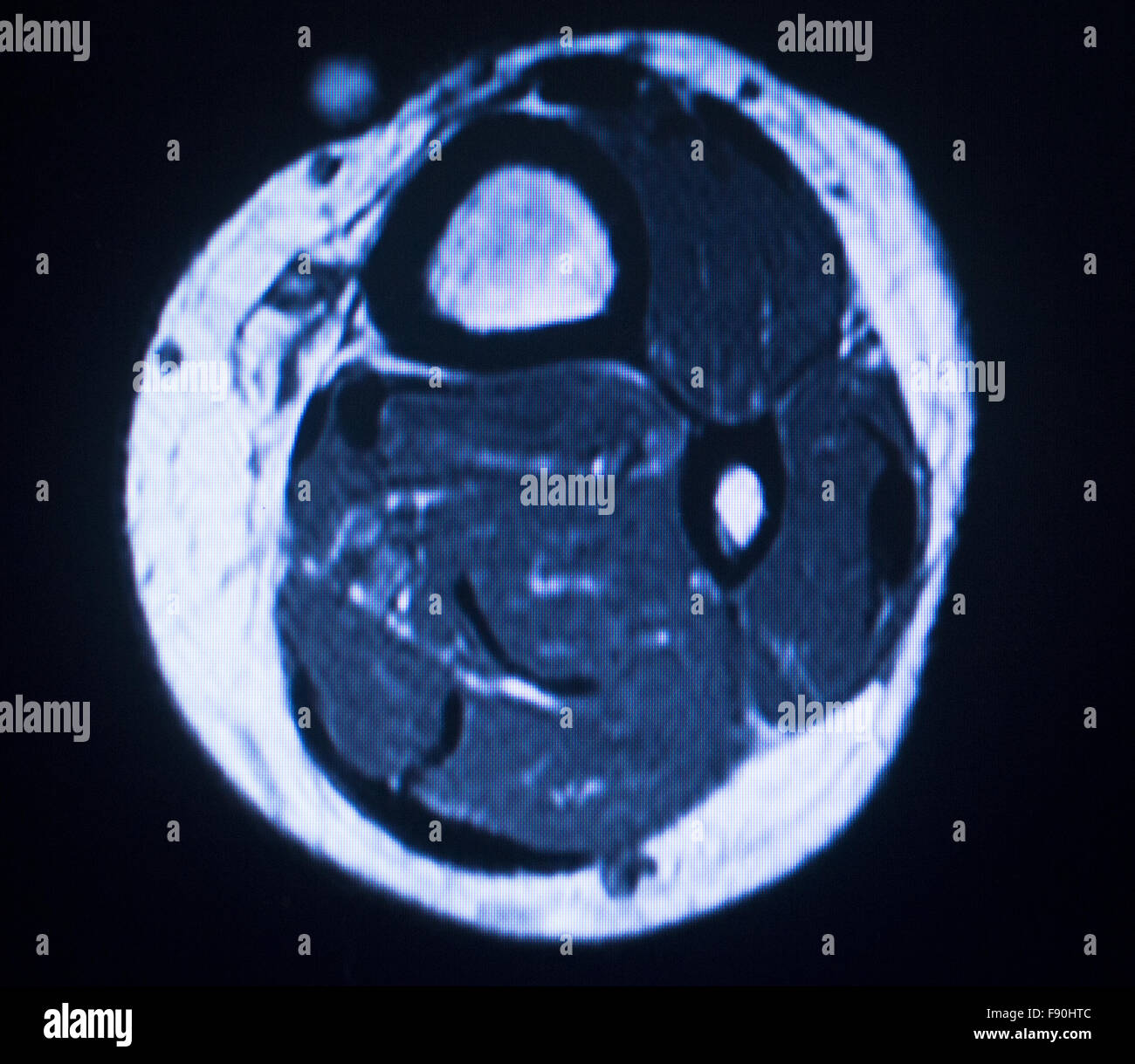 MRI magnetic resonance imaging medical scan test results showing ...