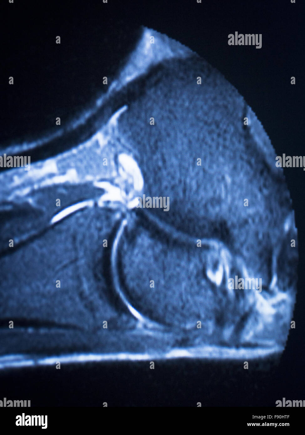 MRI magnetic resonance imaging medical scan test results showing ...