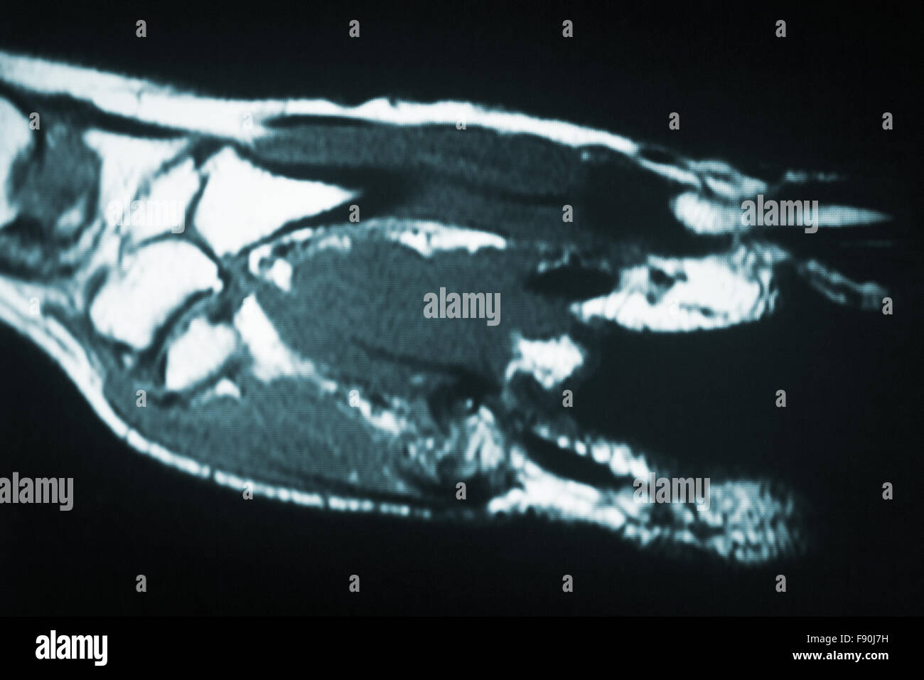 MRI magnetic resonance imaging medical scan test results showing ...