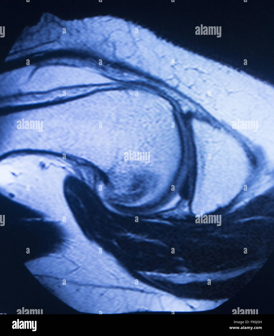 MRI magnetic resonance imaging medical scan test results showing knee ...
