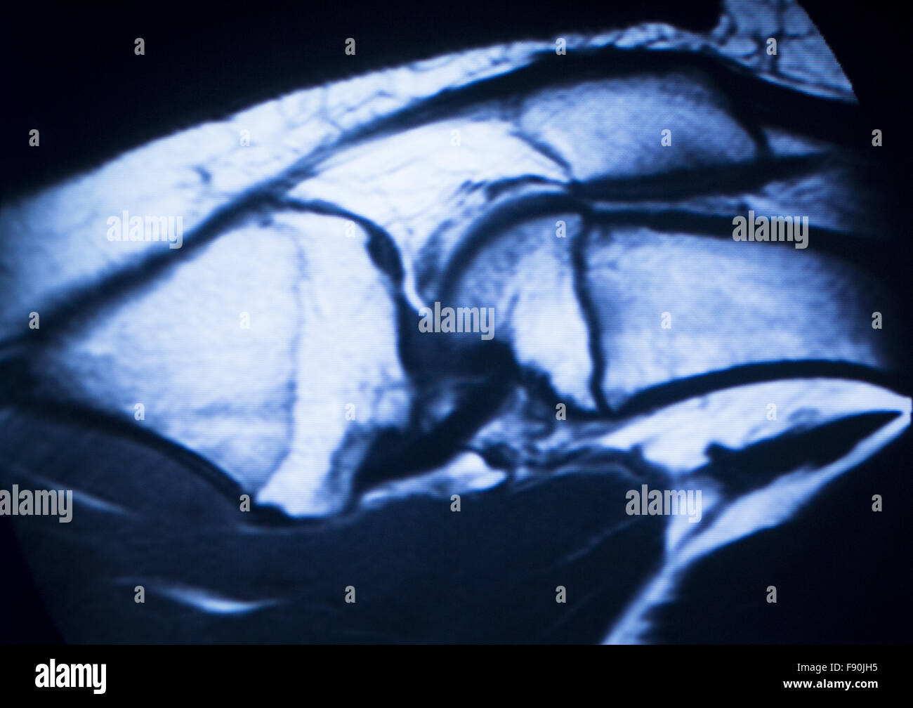 MRI magnetic resonance imaging medical scan test results showing knee ...